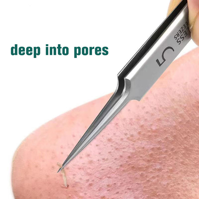 5-in-1 Stainless Steel Acne Clip set German Ultra-fine No. 5 Cell ...