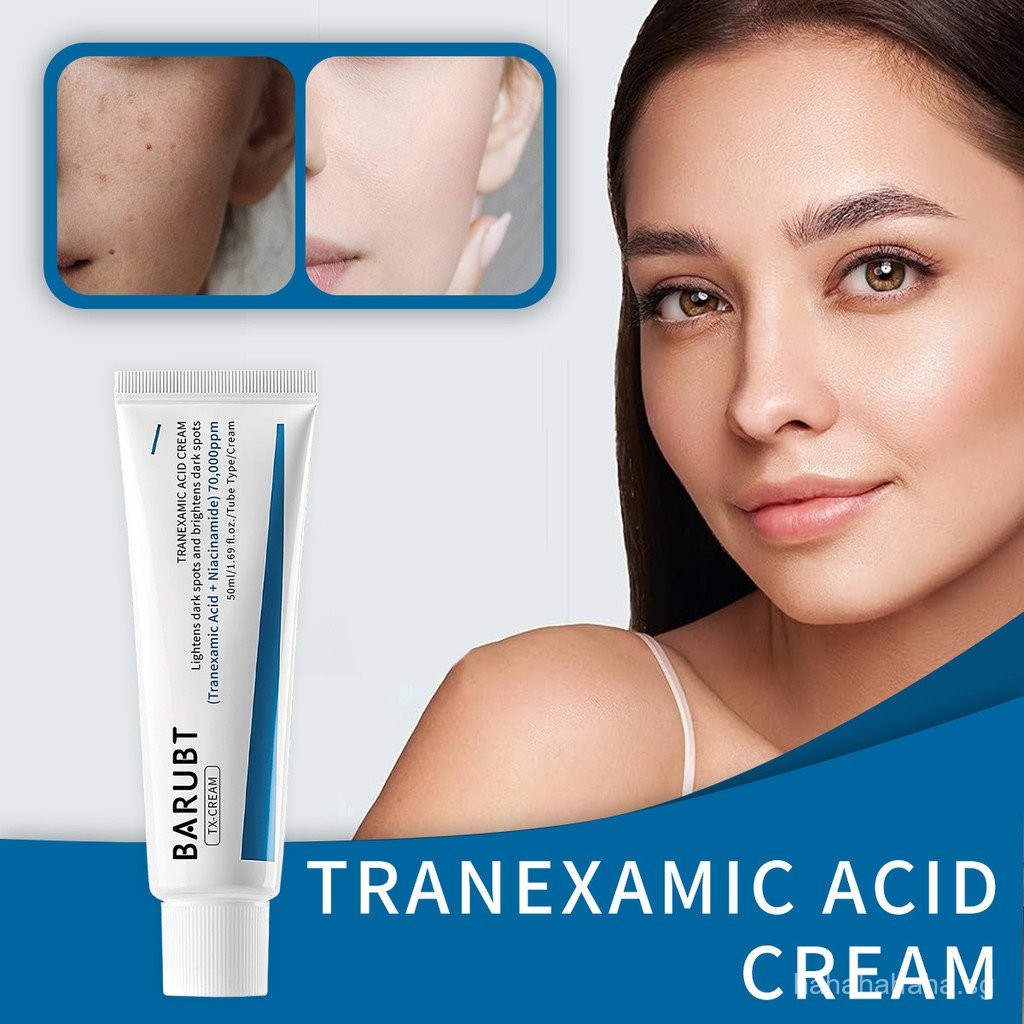 Tranexamic Acid Freckle Cream Emulsifiable Paste Removing Melasma ...