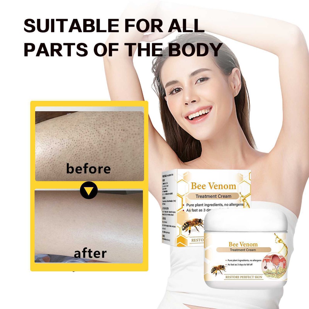 【Buy1 Take 1】Bee Venom Cream, 30g Professional Bee Venom Cream, Bee ...