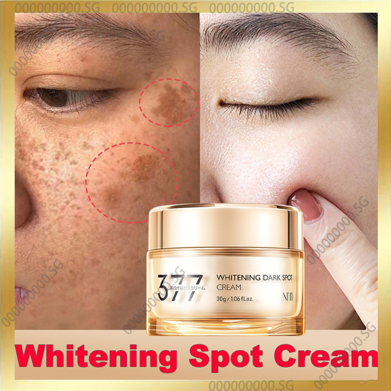 Original Whitening Freckle Cream Moisturiser Melasma Cream 30g Removes ...
