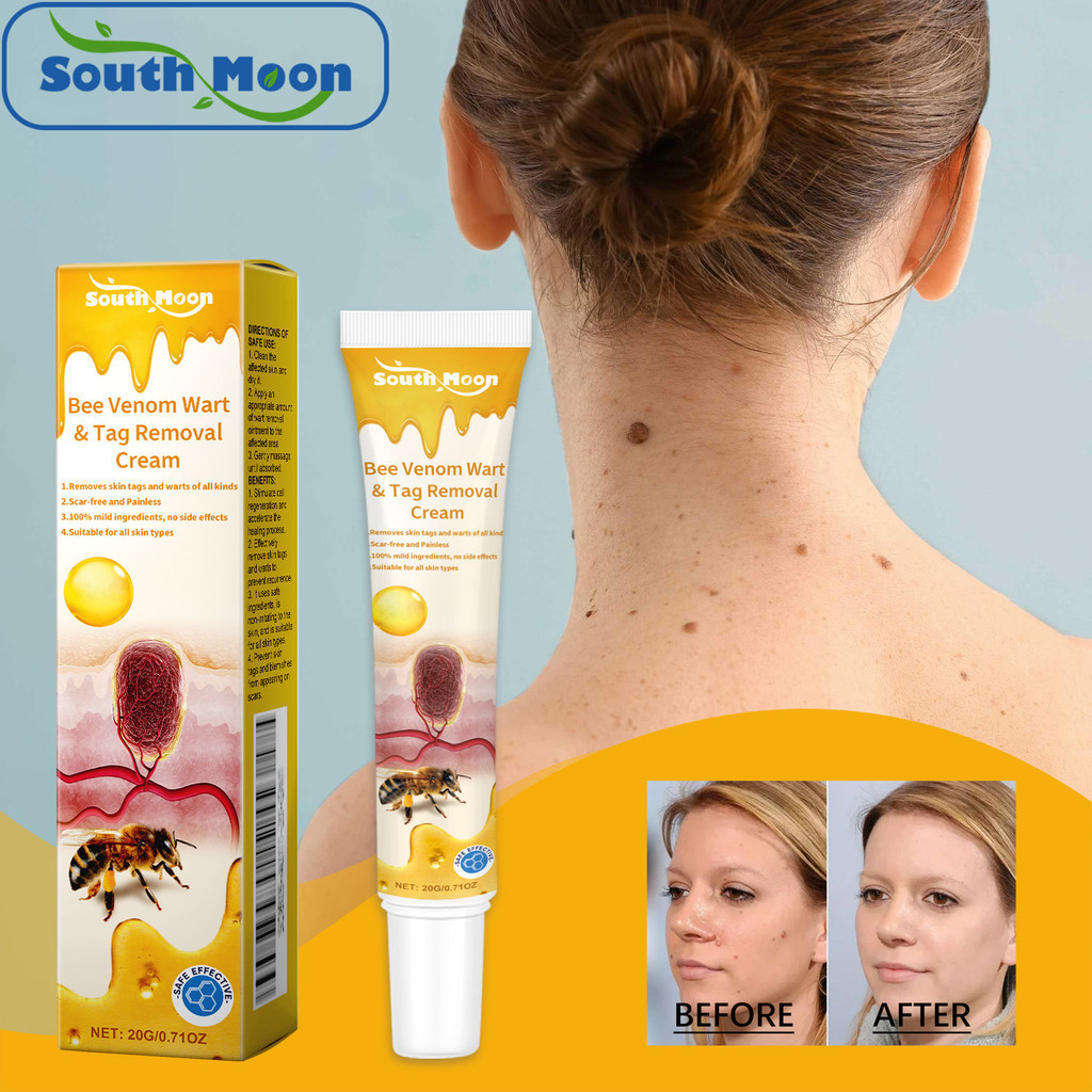 Bee Venom Wart & Tag Removal Cream Bee Venom Moles and Warts Removal ...