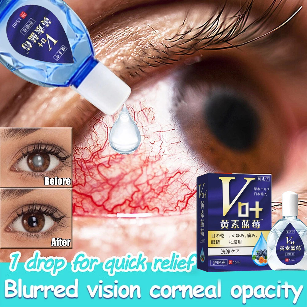 Original Eye Drops Eye Drop Japan 15ml Lutein Eye Drop For Eye Strain ...