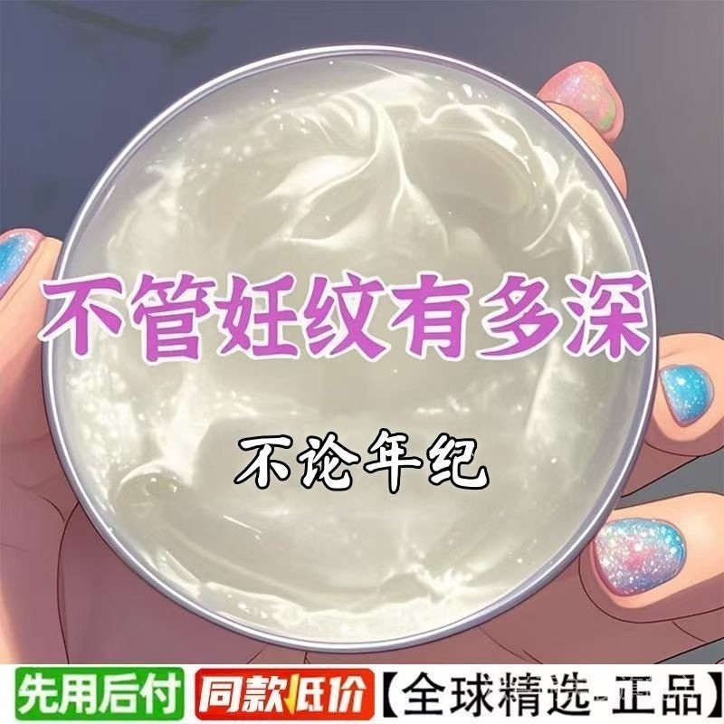 2025New Model for Pregnant Women, Special for Pregnancy Marks, Stretch ...