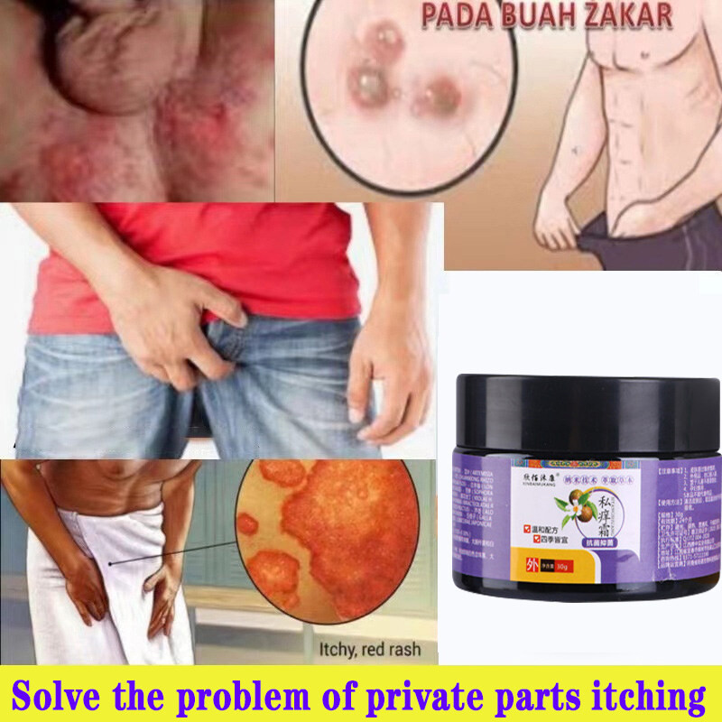 HITAM The Most Powerful Itching Ointment Anti-Fungal Ointment Itchy ...