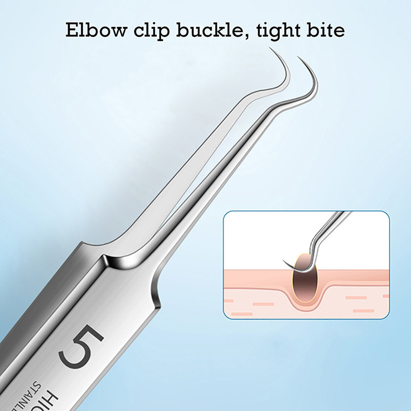 5-in-1 Stainless Steel Acne Clip set German Ultra-fine No. 5 Cell ...