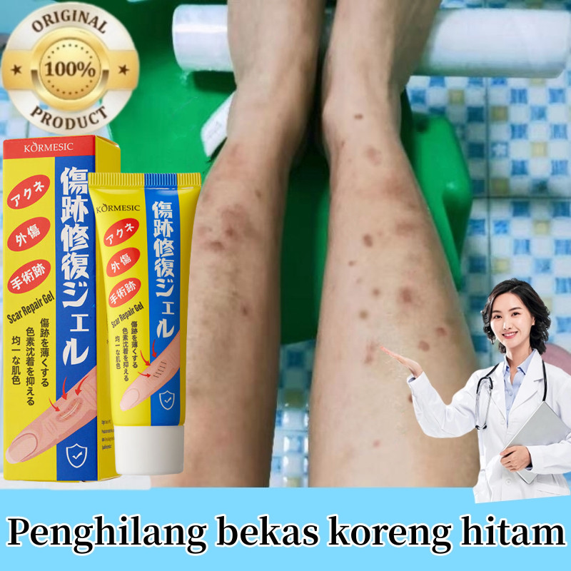 HITAM Kormesic Remove black scars scabs Remove scars on legs Remove ...