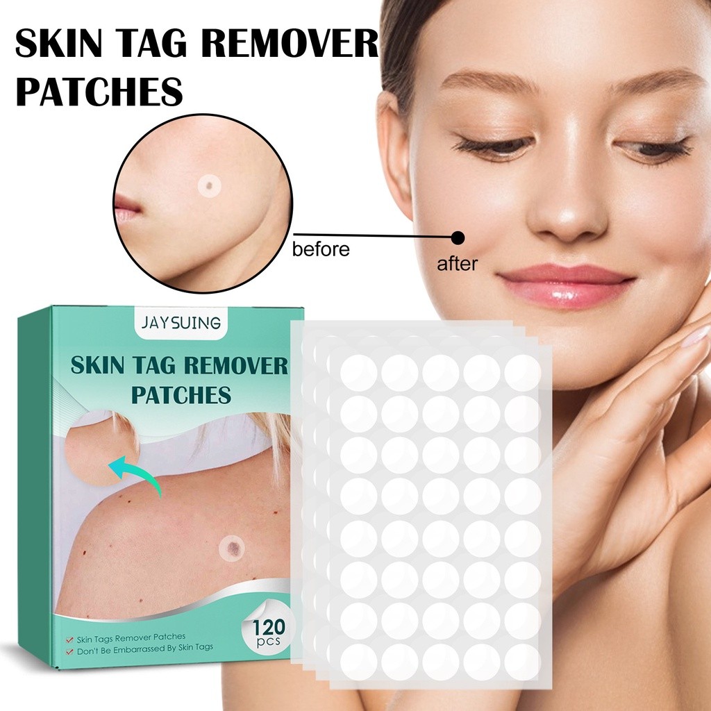 120 Pcs/Box Skin Tag Remove Wart Treatment Sticker Body Pimple Acne ...