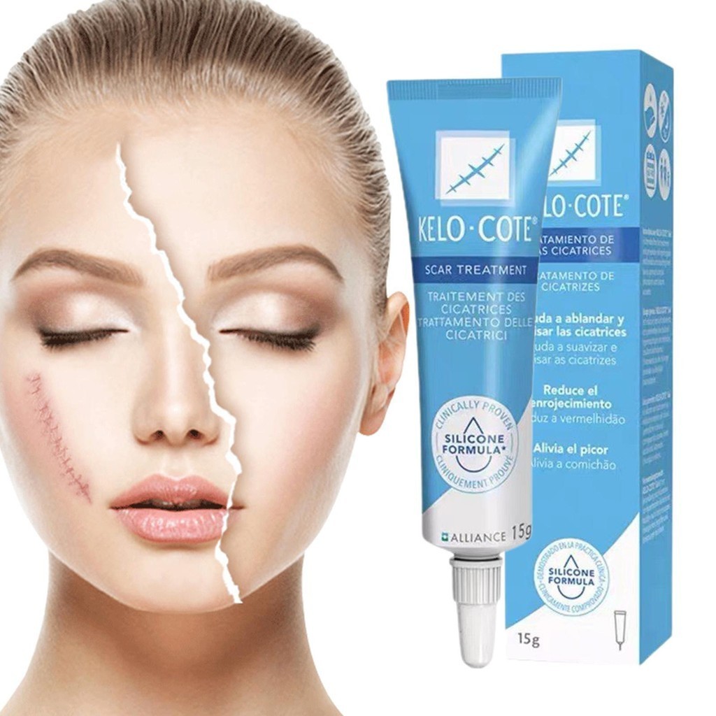 Scar Removal Cream Body Scar Gel Scar Removing Gel Nourishing Scar ...