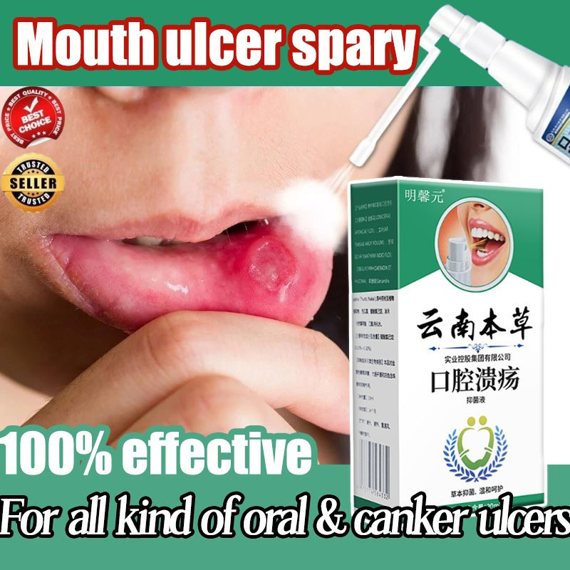 Mouth Ulcer Spray 20ml Herbal Antibacteria Oral Ulcer Spray Mouth Pain ...