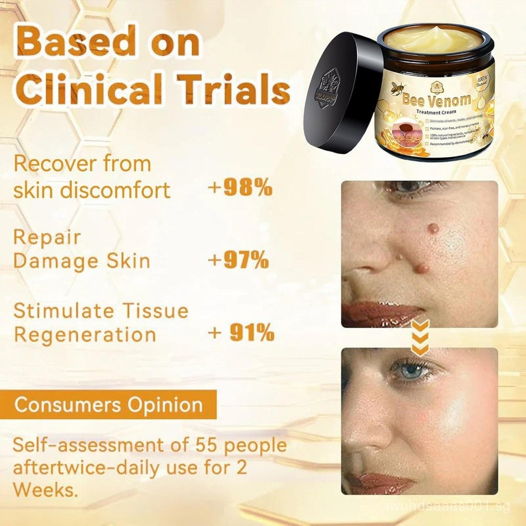 Bee Venom Skin Treatment Cream,Bee Venom Cream,Effectively reduces all ...