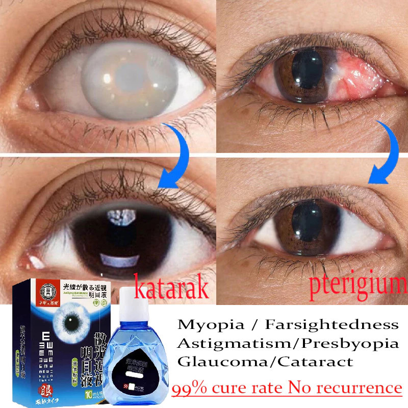 Japan Astigmatism Short-sighted Eye Drops Eye Fatigue Ubat Titis Mata ...