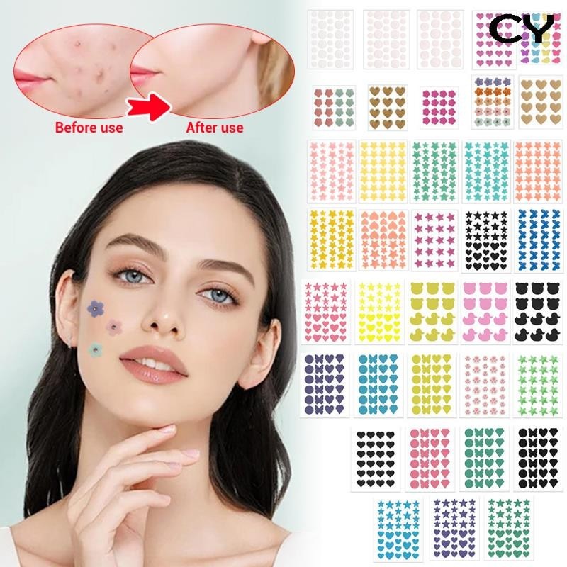 40pcs/sheet Acne Patch PE Colorful Star Shaped Covering Acne Pimple ...