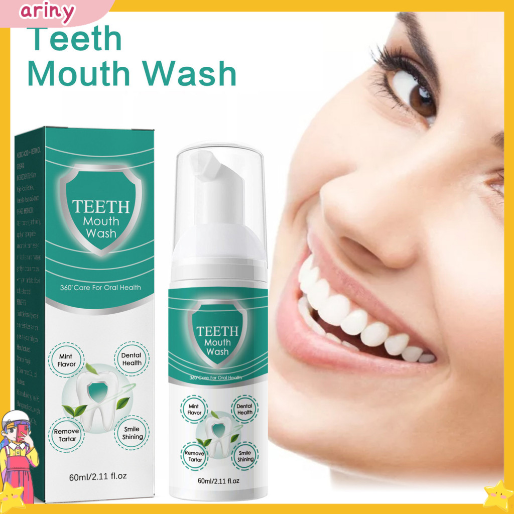 ARINY| Tonsil Stones Mouthwash Gingivitis Relief Mouthwash 60ml Teeth ...