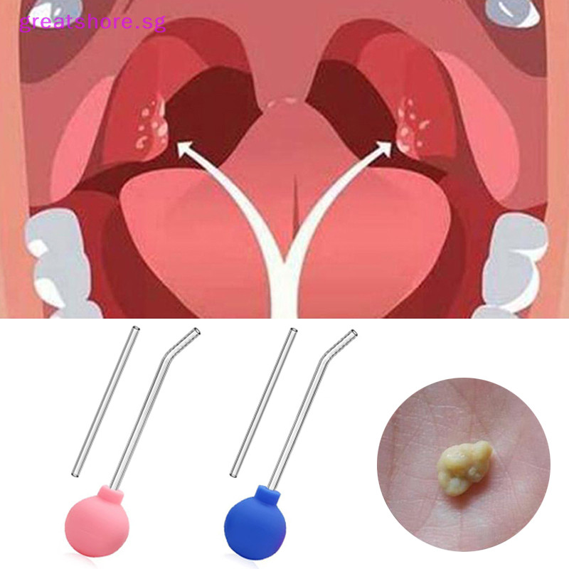 greatshore Tonsil Stone Remover Tool Manual Style Remover Mouth ...