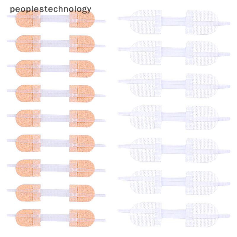 peoplestechnology Zipper Tie Wound Closure Patch Hemostatic Patch Wound ...