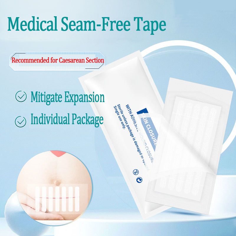 2/3/5/6PCS Medical Wound Closure First Aid Wound Skin Closure Surgical ...