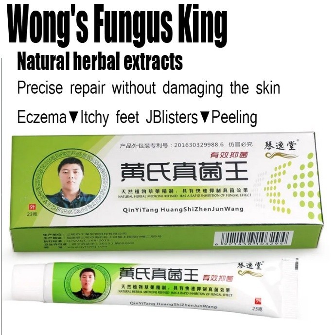 黄氏真菌王运动员脚霜牛皮癣甲真菌病脱皮水泡瘙痒克星 黄氏真菌王Huang's fungus king athlete's foot cream ...