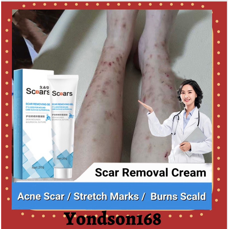 Effective Scar Removal Gel Cream Old Scar Remover Acne Treatment 15g ...