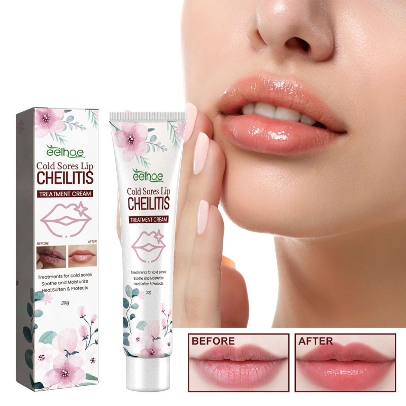 Lip Balm Cheilitis Cream Cold Sores Treatment Fade Lip Lines Anti Cracking Repairing Pellets ...