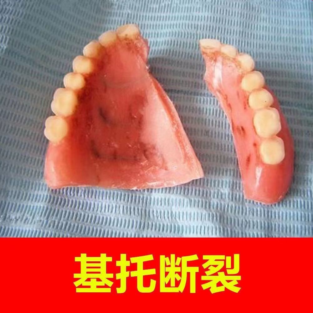 Movable Denture Glue Denture Peeling Sticky Tooth Broken Denture Fixed ...