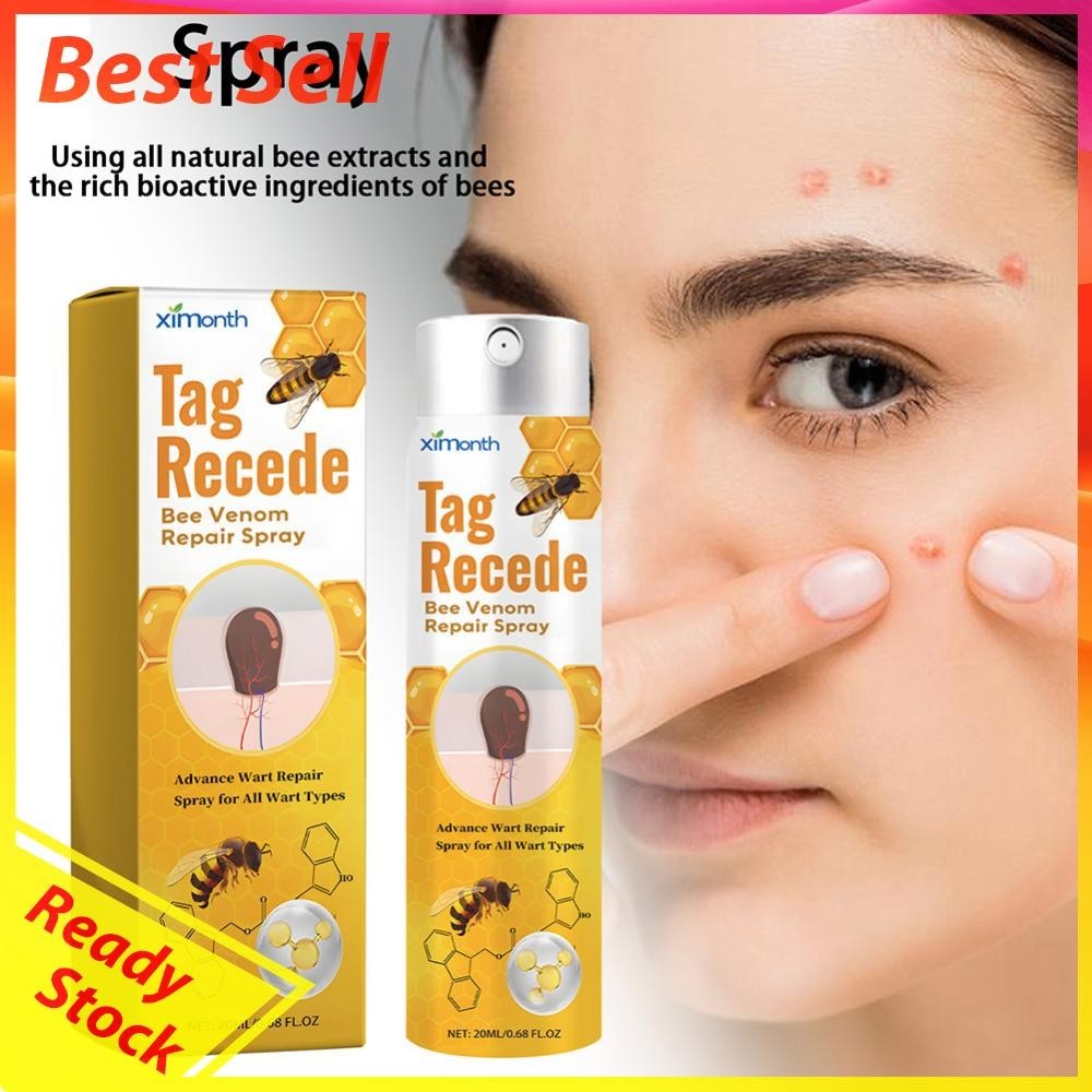 Bee Venom Treatment Spray 20ml Wart Skin Tags Removal Treatment Spray ...