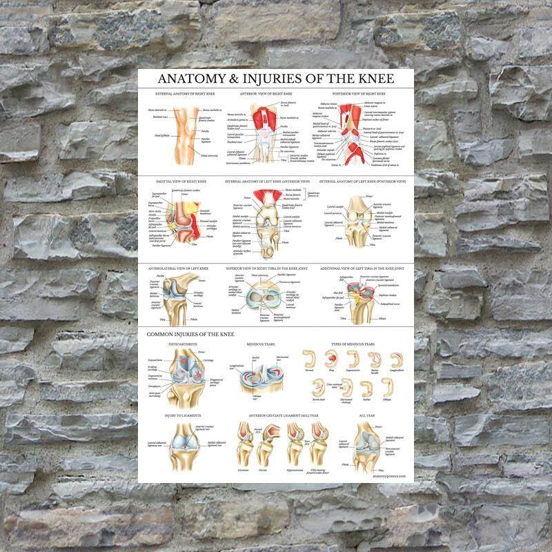 Canvas Wall Art Laminated Anatomy and Injuries of The Knee Poster Knee ...