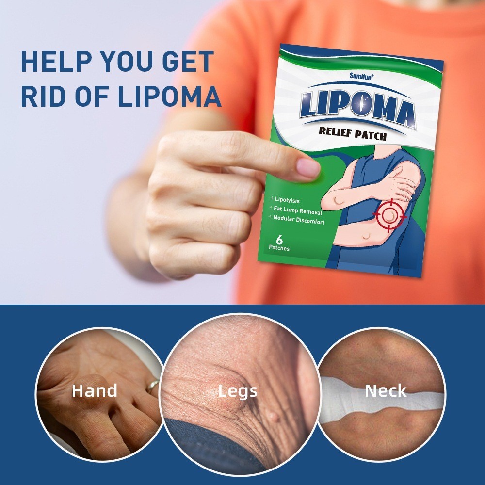 Lipoma cream patch lipoma removal patch eliminate lipoma reduce ...