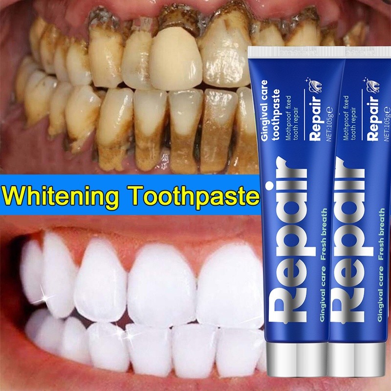 100g Probiotic Whitening Toothpaste Stains Removal,Smoke stains Fresh ...