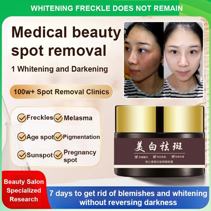 7 Days Whitening over Light Bulb Yushintang Whitening Spot Cream Remove ...