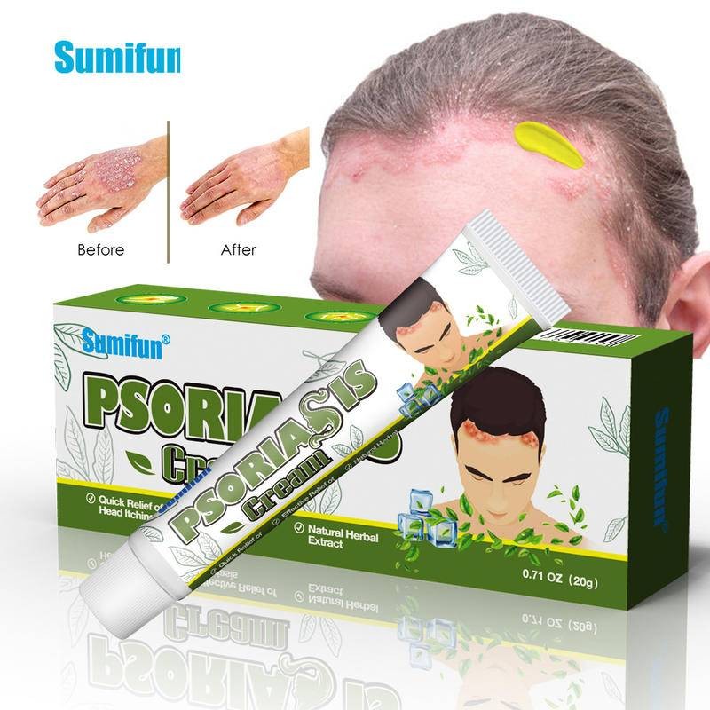 Psoriasis Soothing Cream For Forehead Hair And Body Swelling Antifungal ...