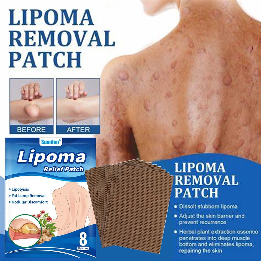 Lipoma Removal Patch Herbal Fat Lump Removal Patches Safe and Deep ...