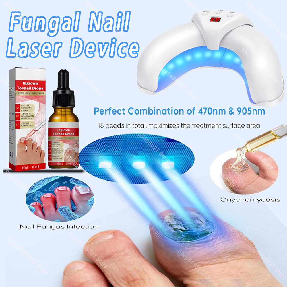 Fungal Nail Laser Device Repair Fast Nails Fungus Onychomycosis Repair ...