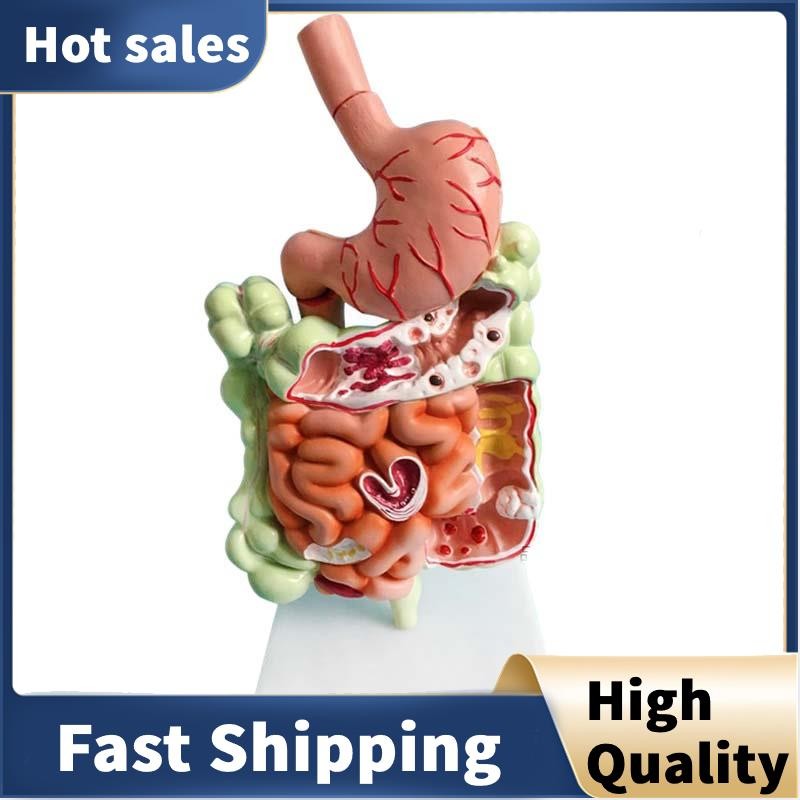 Human Digestive System Model Stomach Anatomy Large Intestine Cecum ...