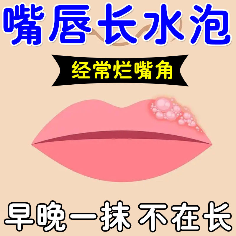Lip Long Lip Bubble Lip Herpes Dedicated Lip Fire Rotten Lip Horns Red ...