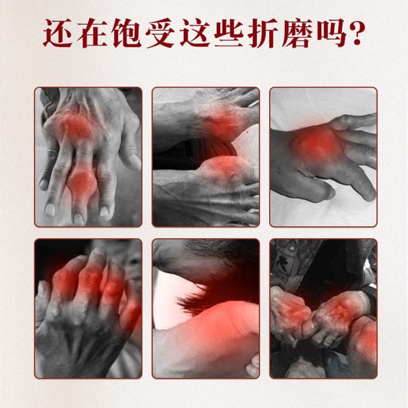 Pain.Wind Cream Finger Tendon Sheath Crystalline Swelling Expansion ...
