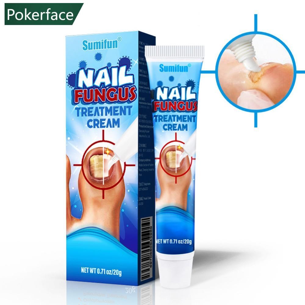 POKERFACE Mild Onychomycosis Cream Onychomycosis Care Repair Cream ...