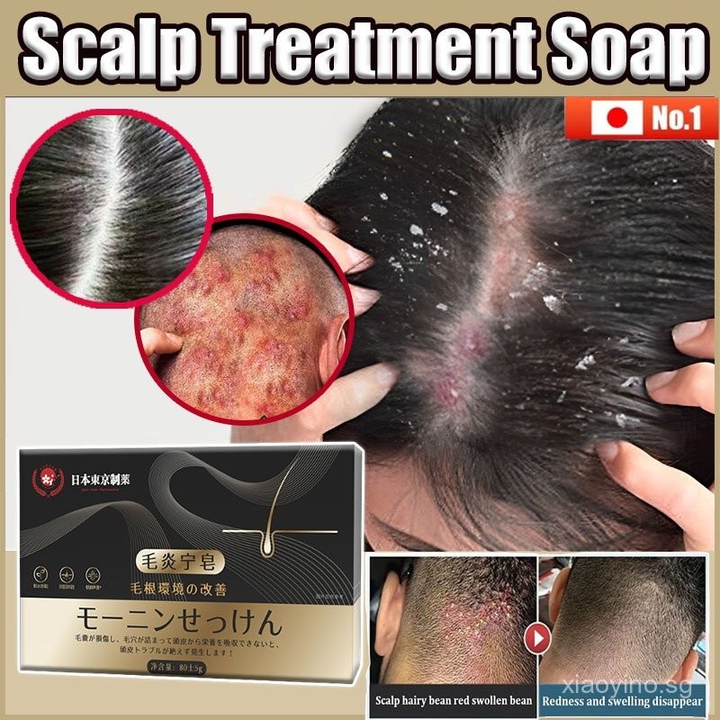 Japan Dandruff Scalp Treatment Soap 85g Scalp Folliculitis Anti ...