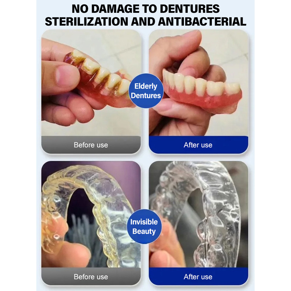 Invisible Braces Keep Clean Invisible Braces Cleaning Effervescent ...