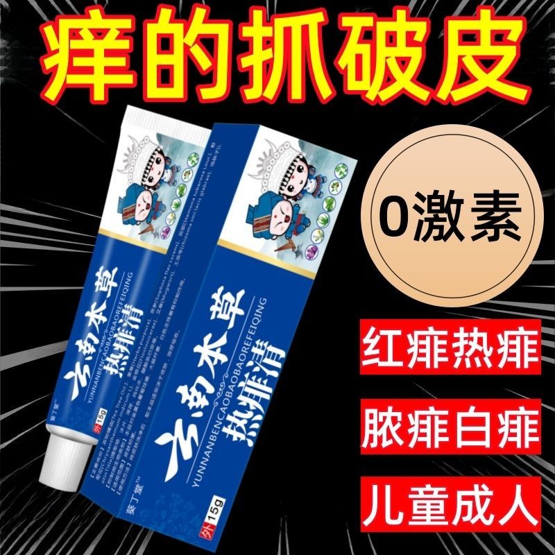 New Product#Adult and Children Heat Prickly Heat Ointment Heat Pimple ...