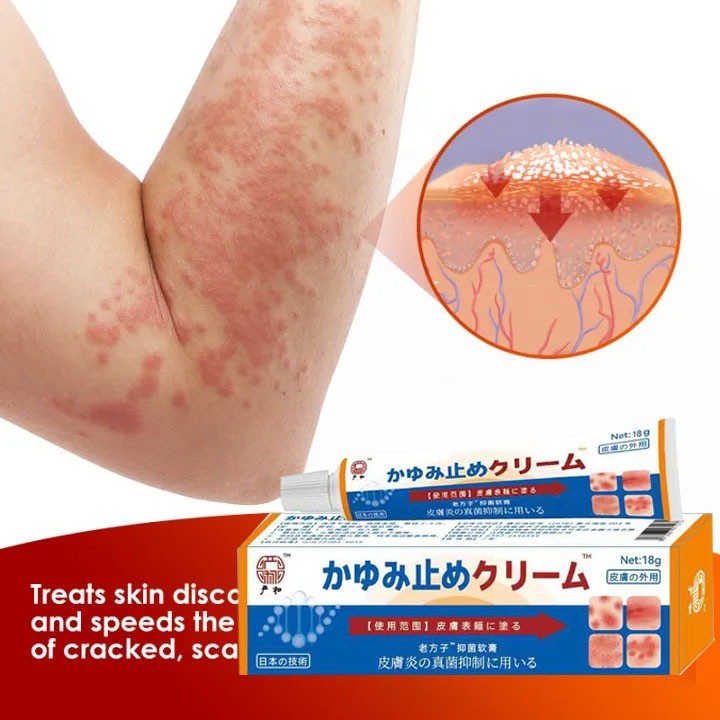 Japanese imported atopic dermatitis cream to support Eczema ...