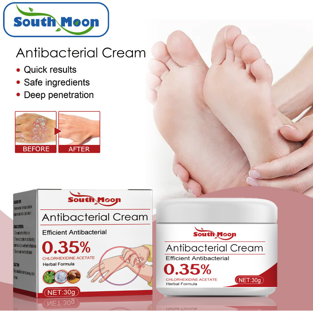 JXPN South Moon Psoriasis Cream 30g Skin Redness Swelling Pruritus ...