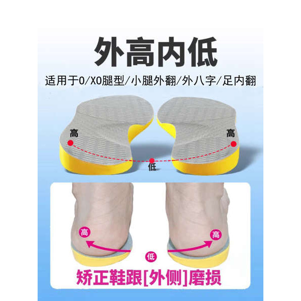 o leg Leg Corrector O-Type Leg Correction O-Shaped Leg Correction ...