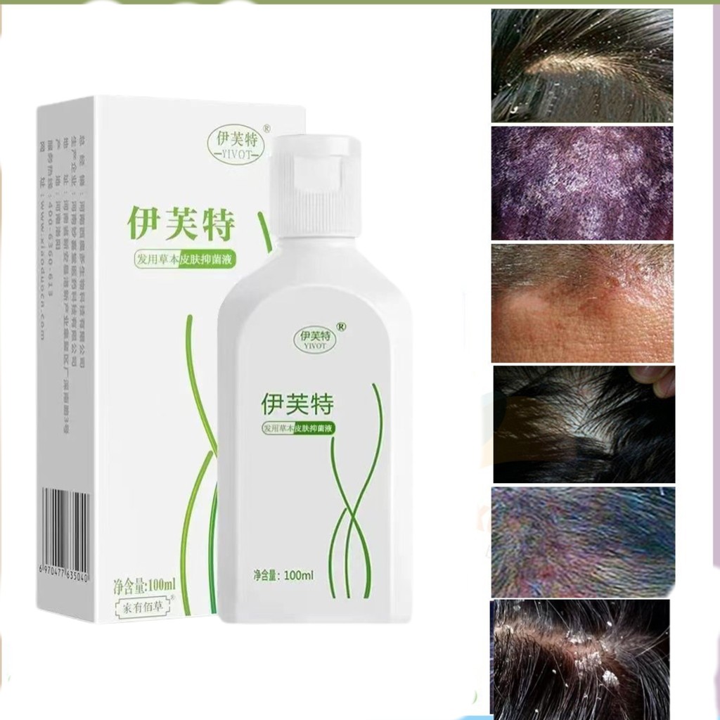 Ivat Shampoo Seborrhea Head Psoriasis Psoriasis Seborrheic Dermatitis ...