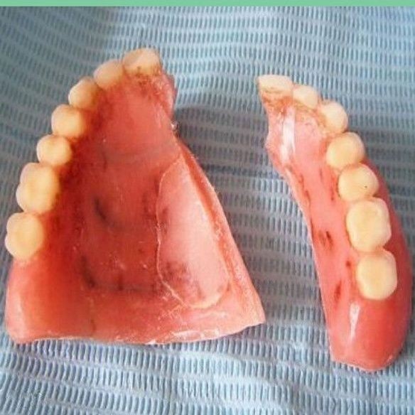 Movable Denture Glue Denture Peeling Sticky Tooth Broken Denture ...