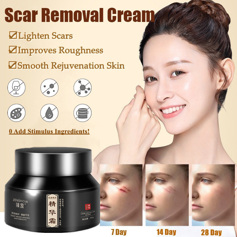 ZENSHOW Scar Smooth Cream 50g Lightens Scar Marks Improves Roughness ...