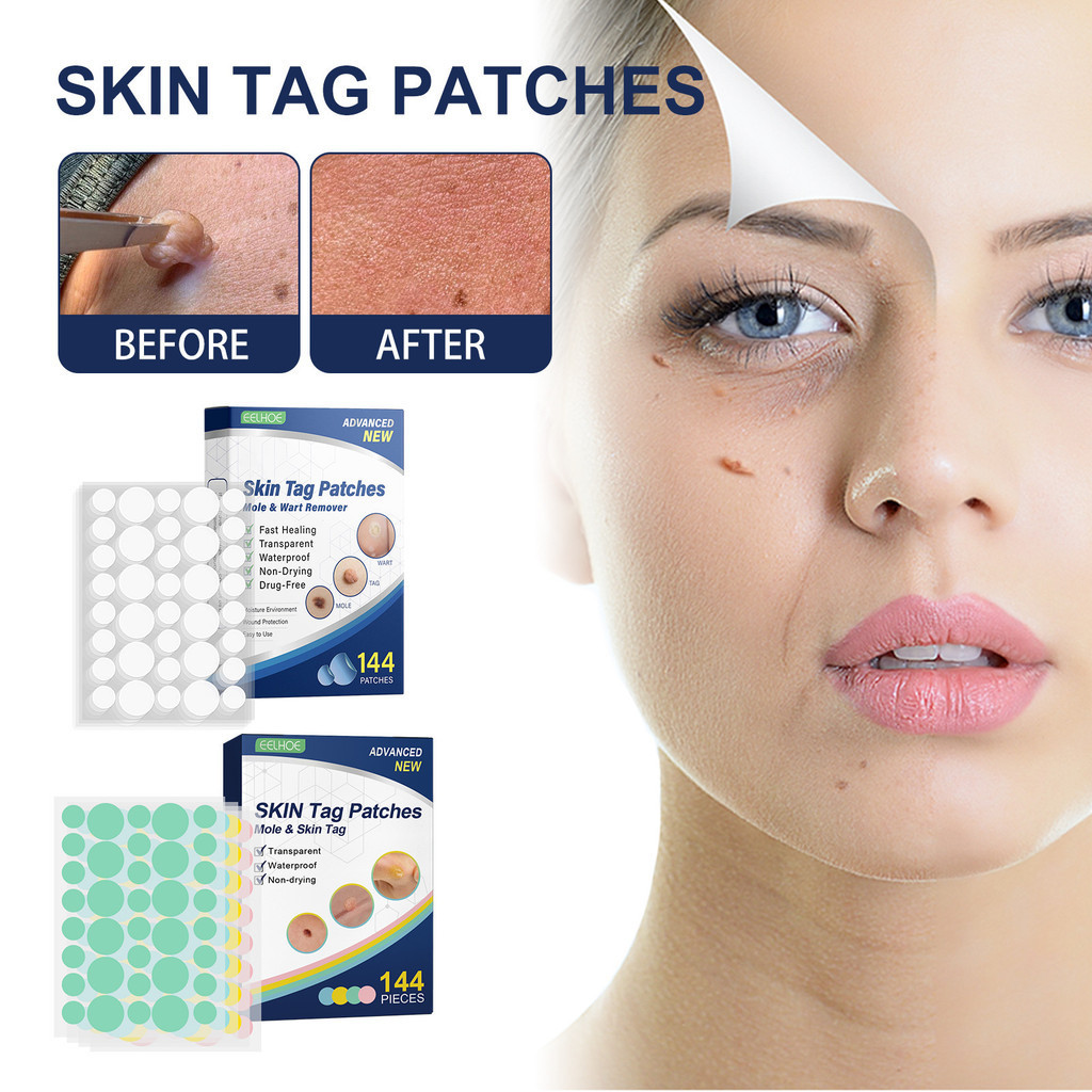 Ke Wart Stickers Cleansing Skin Labels Fade Black Moles Fleshy Granules ...