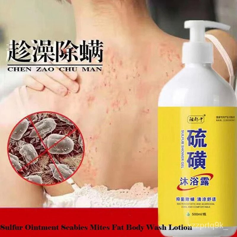 Effective Sulfur Ointment Scabies Mites Fat Bath Body Cream Sulphur ...