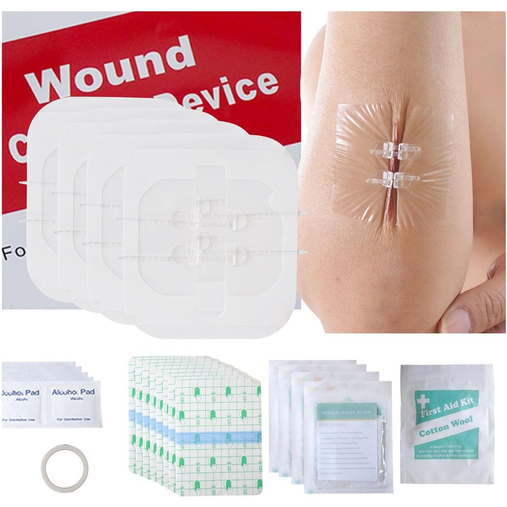 Emergency Wound Closure Devices, Zipper Wound Closure Strips ...