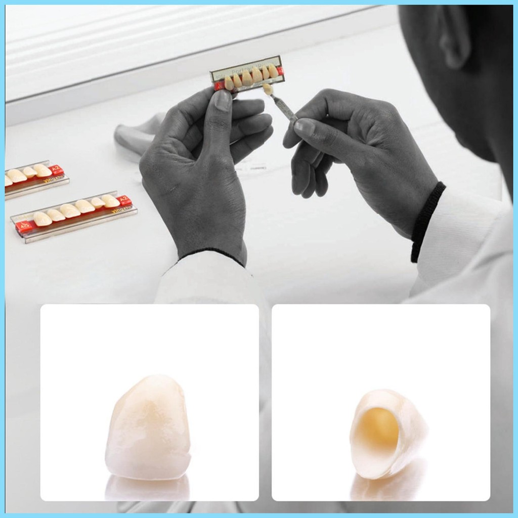 Artificial Tooth Synthetic Acrylic Resin Tooth Upper Lower Denture ...