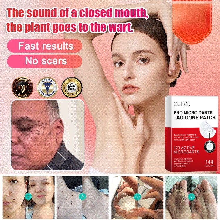 🔥Wart Removal🔥Quick Wart Removal Patch/Plant-Based Wart Removal/Plant ...